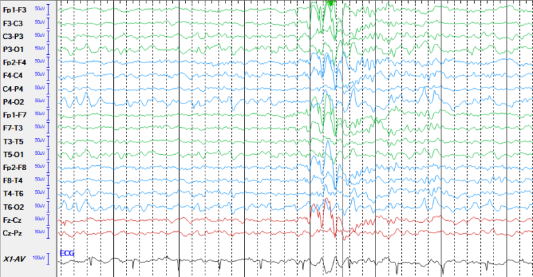 eeg – Children's Medical Center